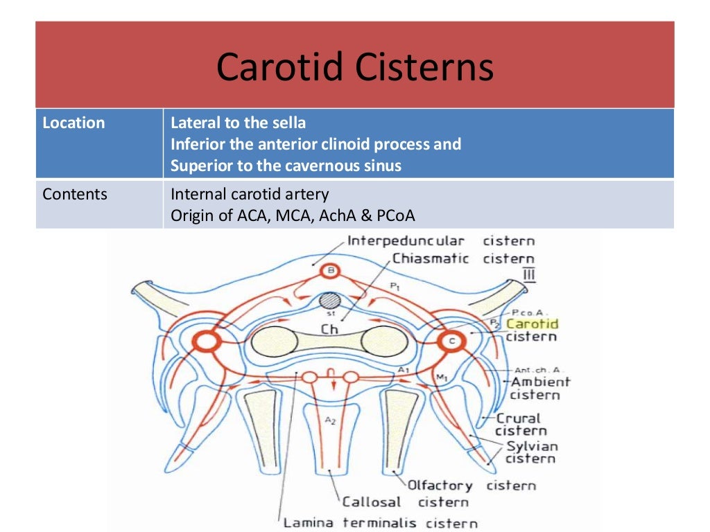 Cisternae Pronunciation