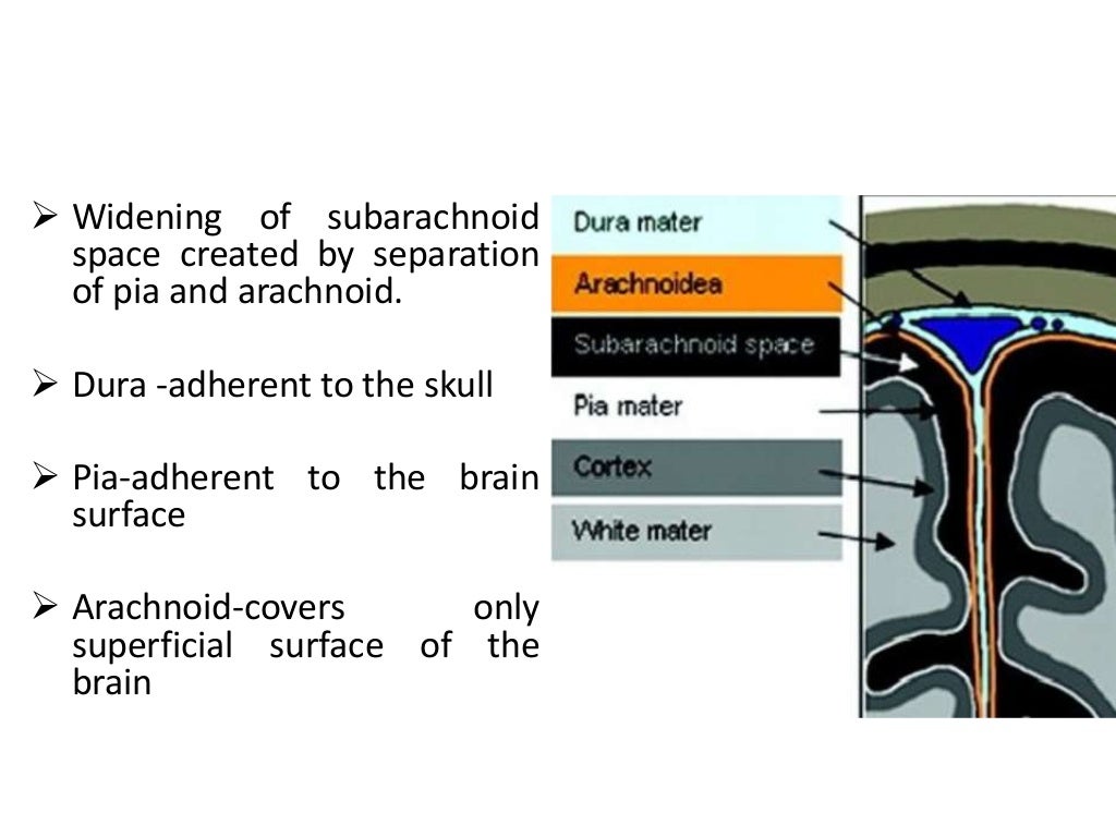 Cisternae Pronunciation