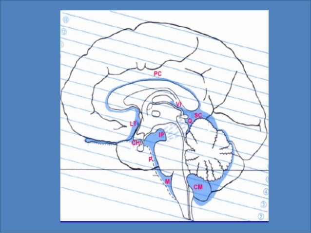 Cisternae Pronunciation