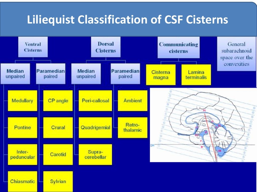 Cisterns of brain and its contents along with its classification and