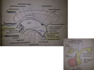 Cisterns 360° | PPT