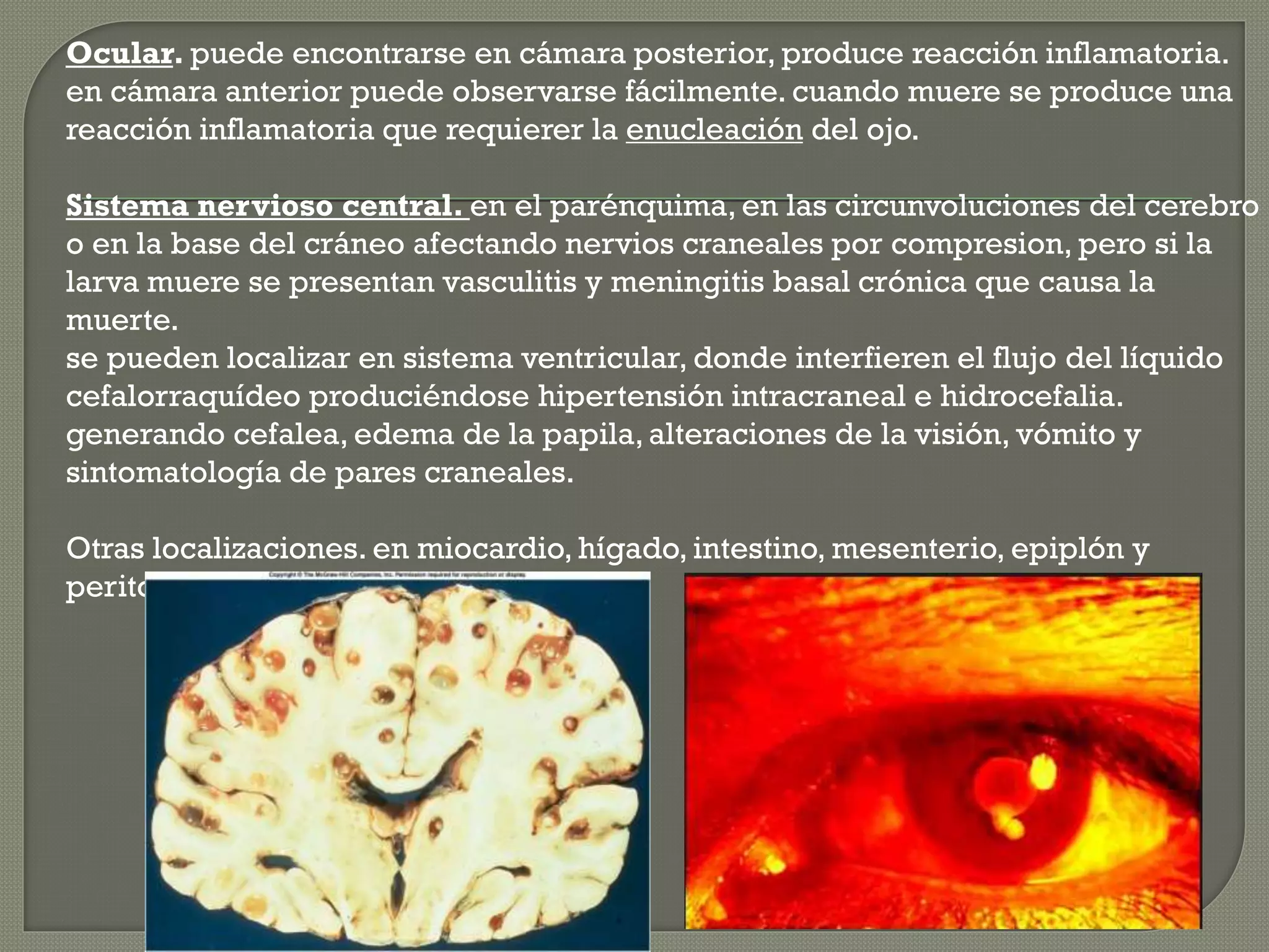 Cisticercosis | PPTX