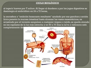 Cisticerco De La Tenia Solium