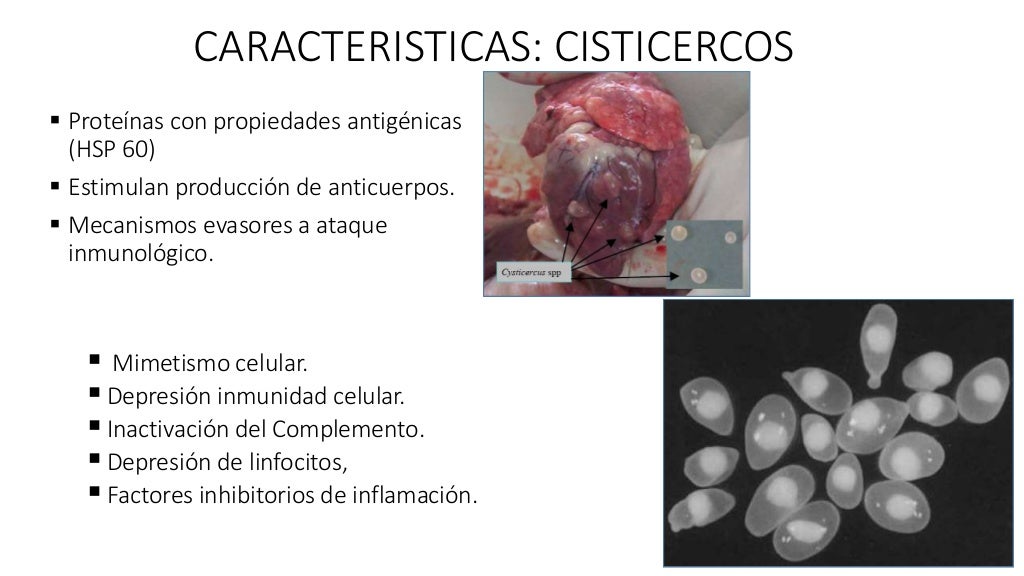 Cisticercosis