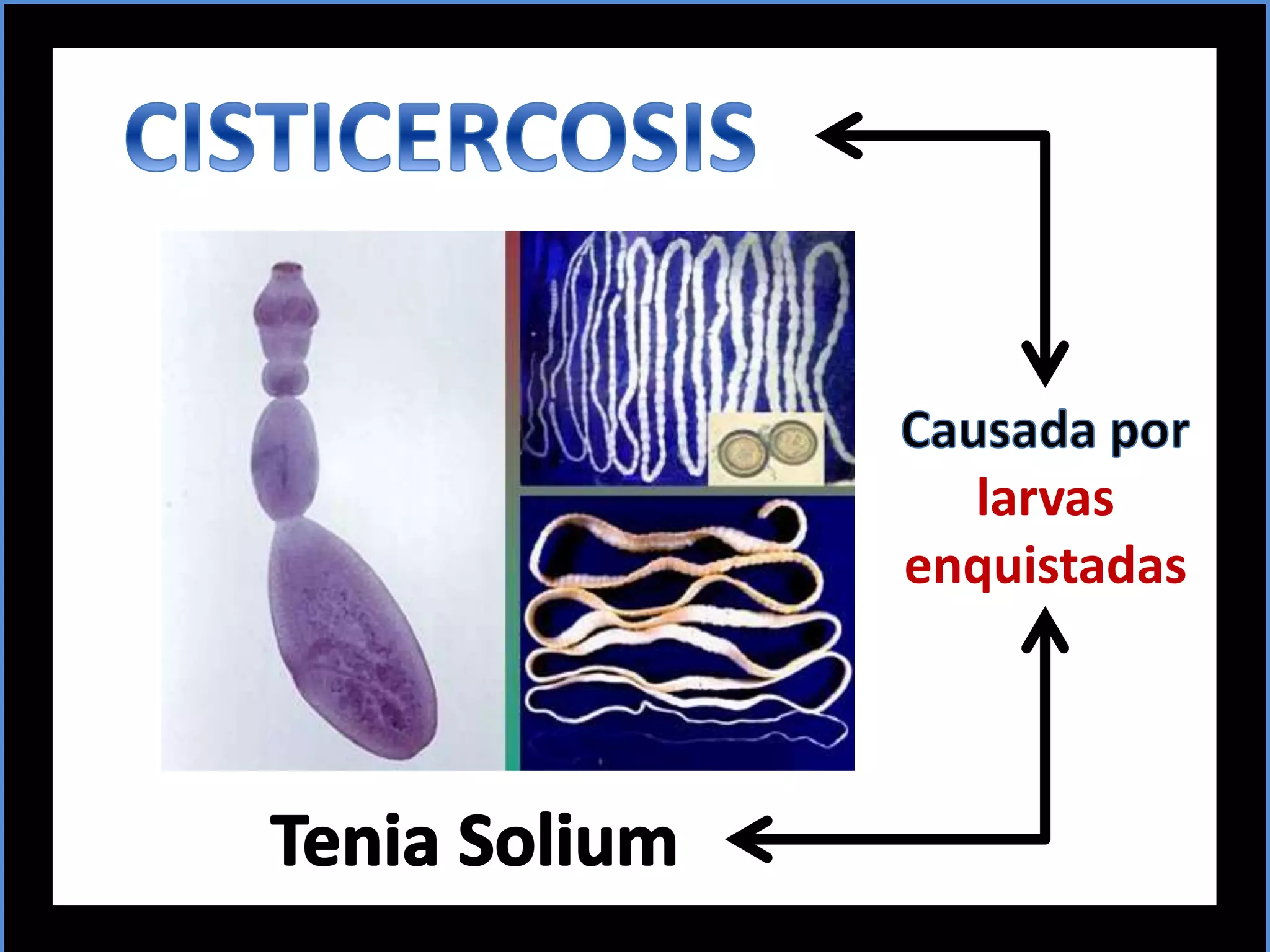 Cisticercosis | PPT