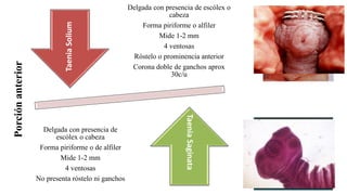 Cisticercosis humana - Parasitología medica.pdf