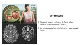 Cisticercosis humana - Parasitología medica.pdf