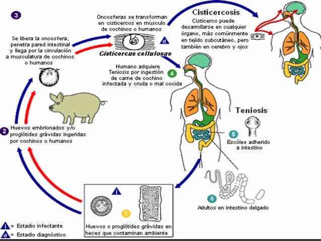 Cisticercosis (1)