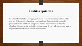 Cistitis | PPTX
