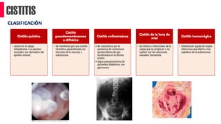 CISTITIS.pdf