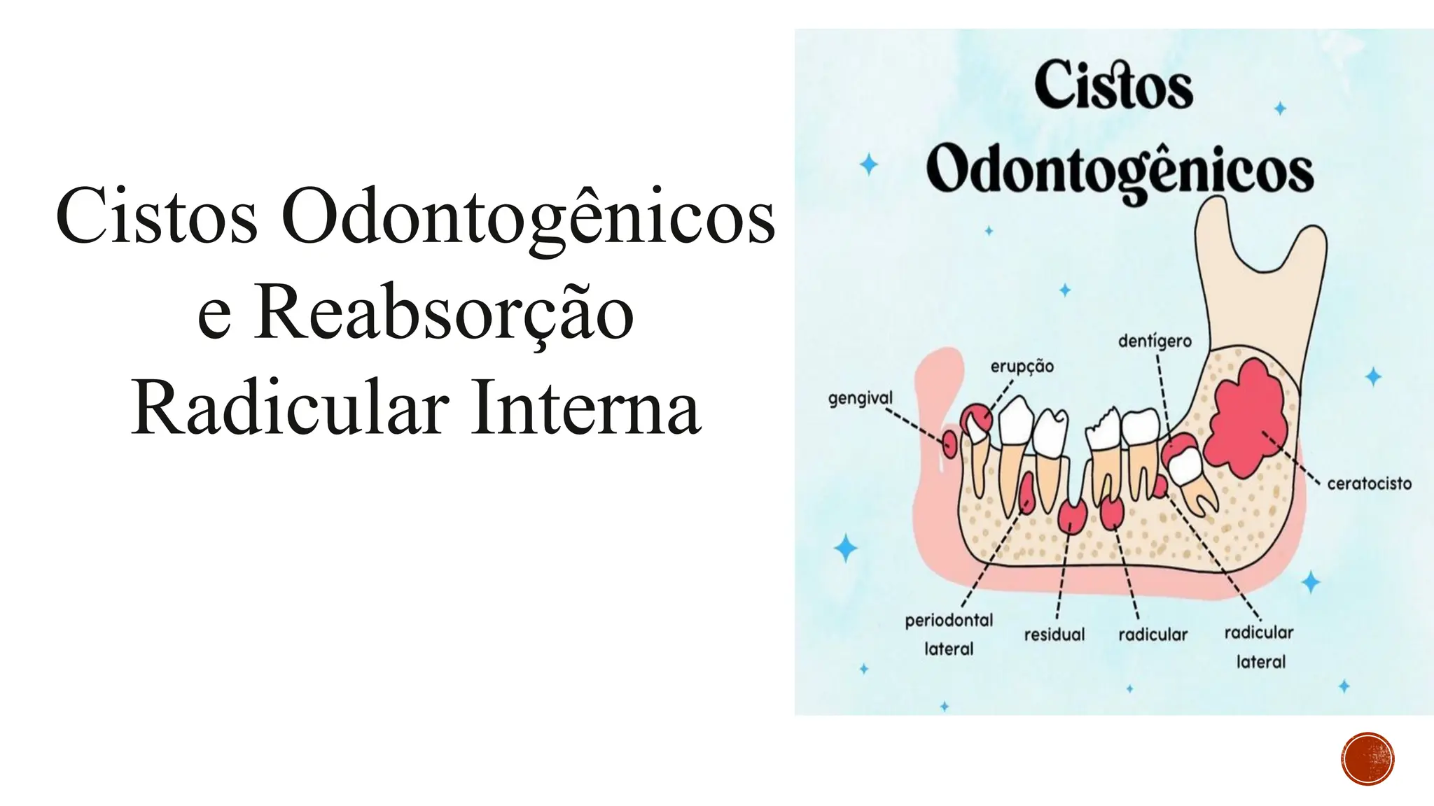 cistos-odontogenicos-e-reabsorcao-radicular-interna-250326192048 ...