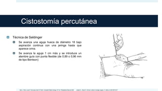 Cistostomía ....pptx