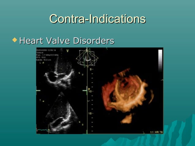 Contra-indications to an electrolysis treatment | PPT | Skin and ...