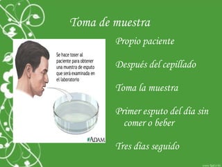 Citología de esputo | PPT