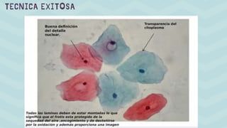 citología exfoliativa de las celulas basales en el endocervix | PPTX