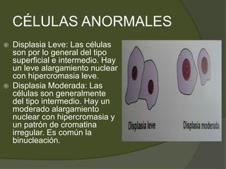 Citología y colposcopía | PPTX