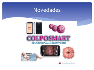 Citología y colposcopia | PPTX