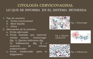 Citologia Cervical.pptx