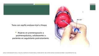 CITOLOGIA CERVICAL procedimiento, indicaciones, resultados. | PPTX