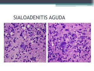 Citología glandulas salivales | PPTX