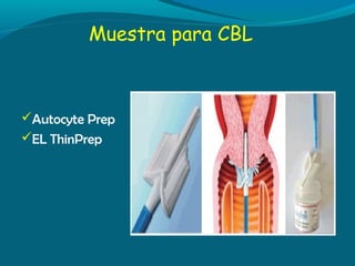 Citologia rossana | PPT