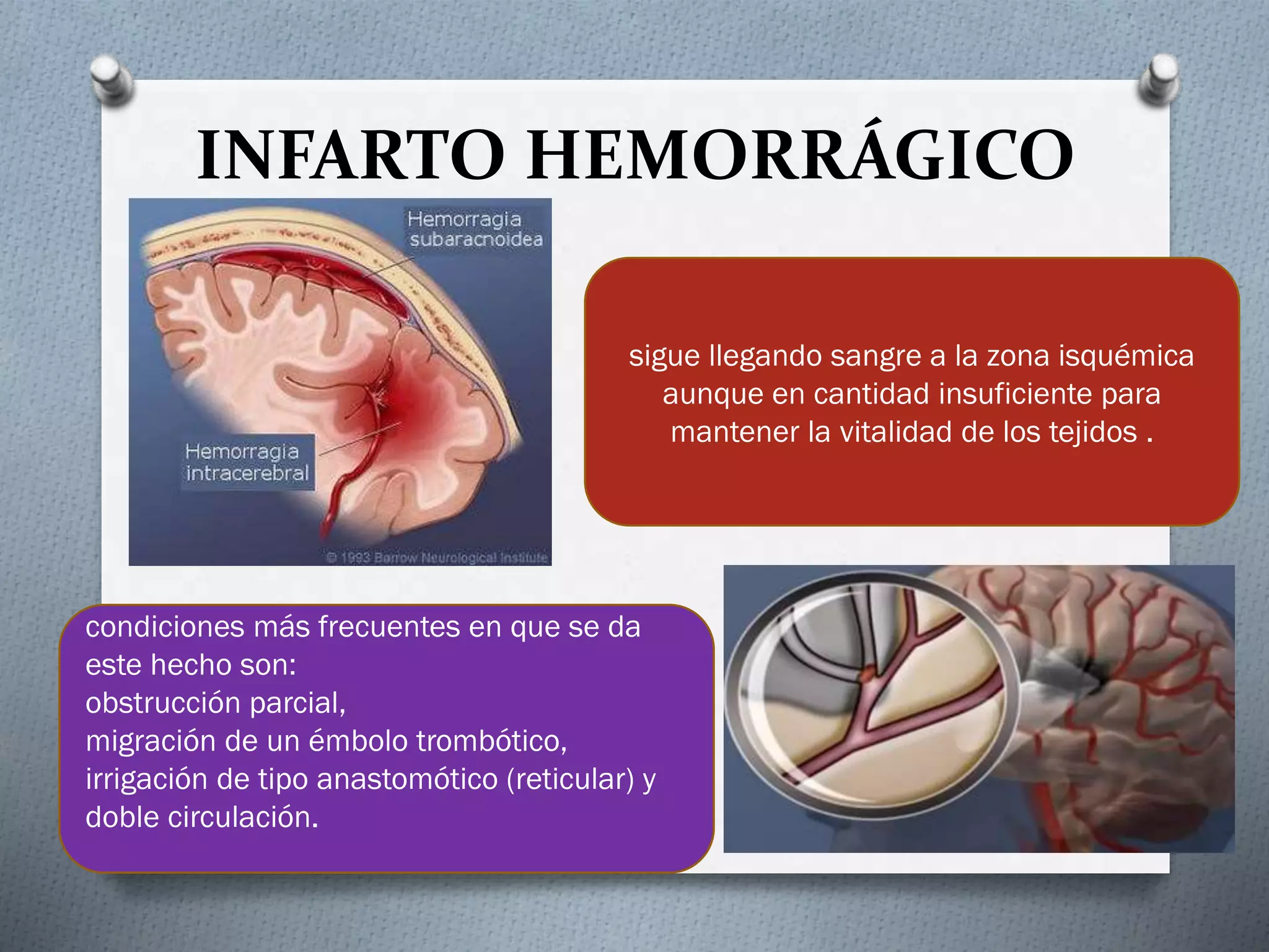 TIPOS DE INFARTO | PPTX