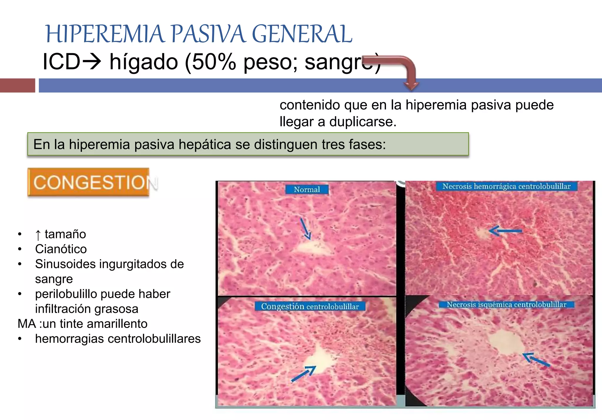 HIPEREMIA Y CONGESTIÓN TRANSTORNOS HEMODINAMICOS | PPTX