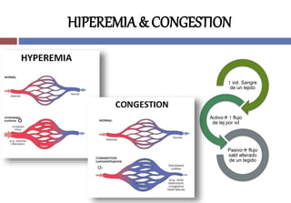 HIPEREMIA Y CONGESTIÓN TRANSTORNOS HEMODINAMICOS | PPTX