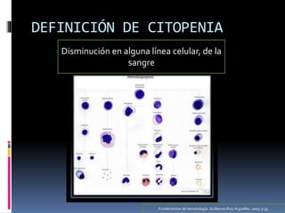 Citopenias por medicamentos | PPTX