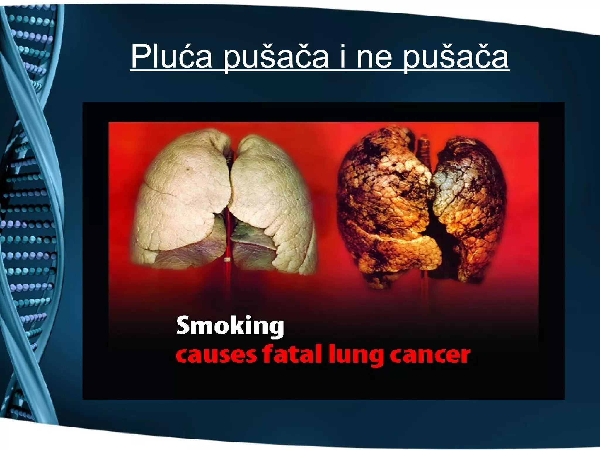 Citostatici prezentacija | PPT