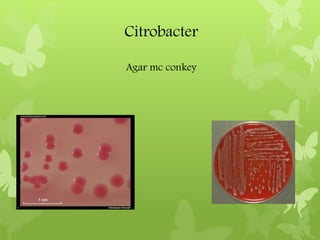 Citrobacter | PPTX