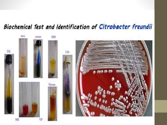 Citrobacter & Edwardsiella | PPTX