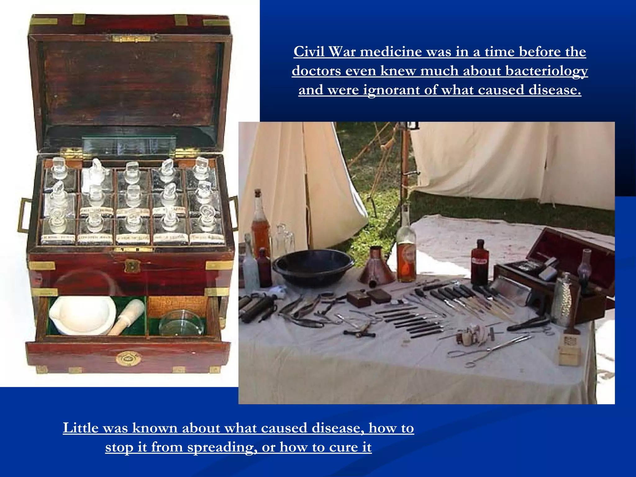 Civil war medicine | PPT