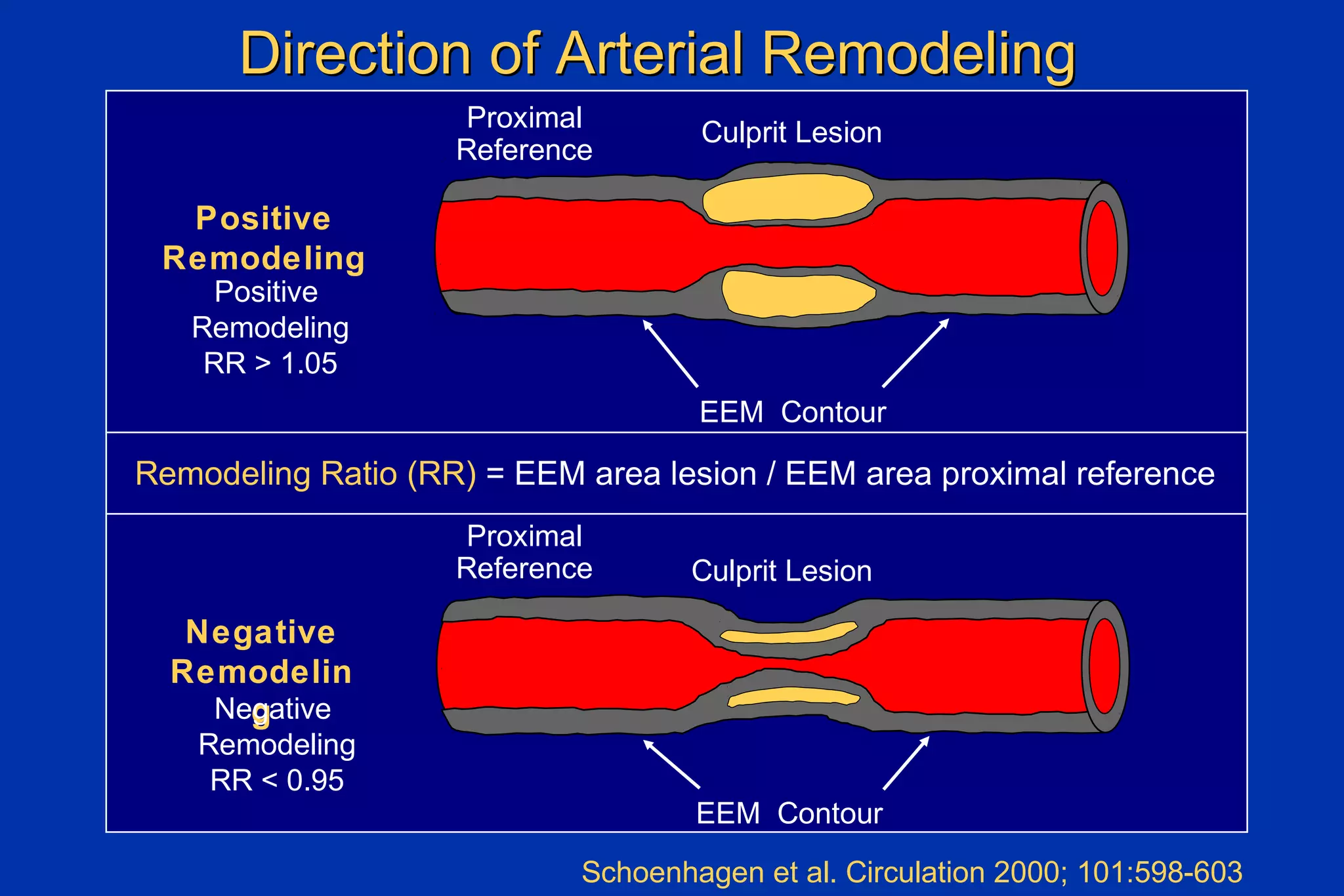 Arterial remodeling in st vs unst cs | PPT | Heart and Cardiovascular ...