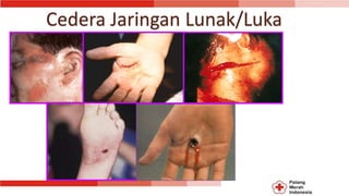 Kasus trauma cidera jaringan lunak atau lukapptx | PPT