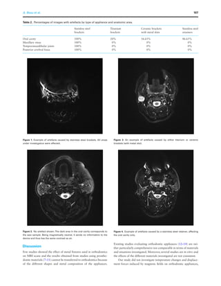 Magnetic resonance imaging artifacts and fixed orthodontic attachments ...