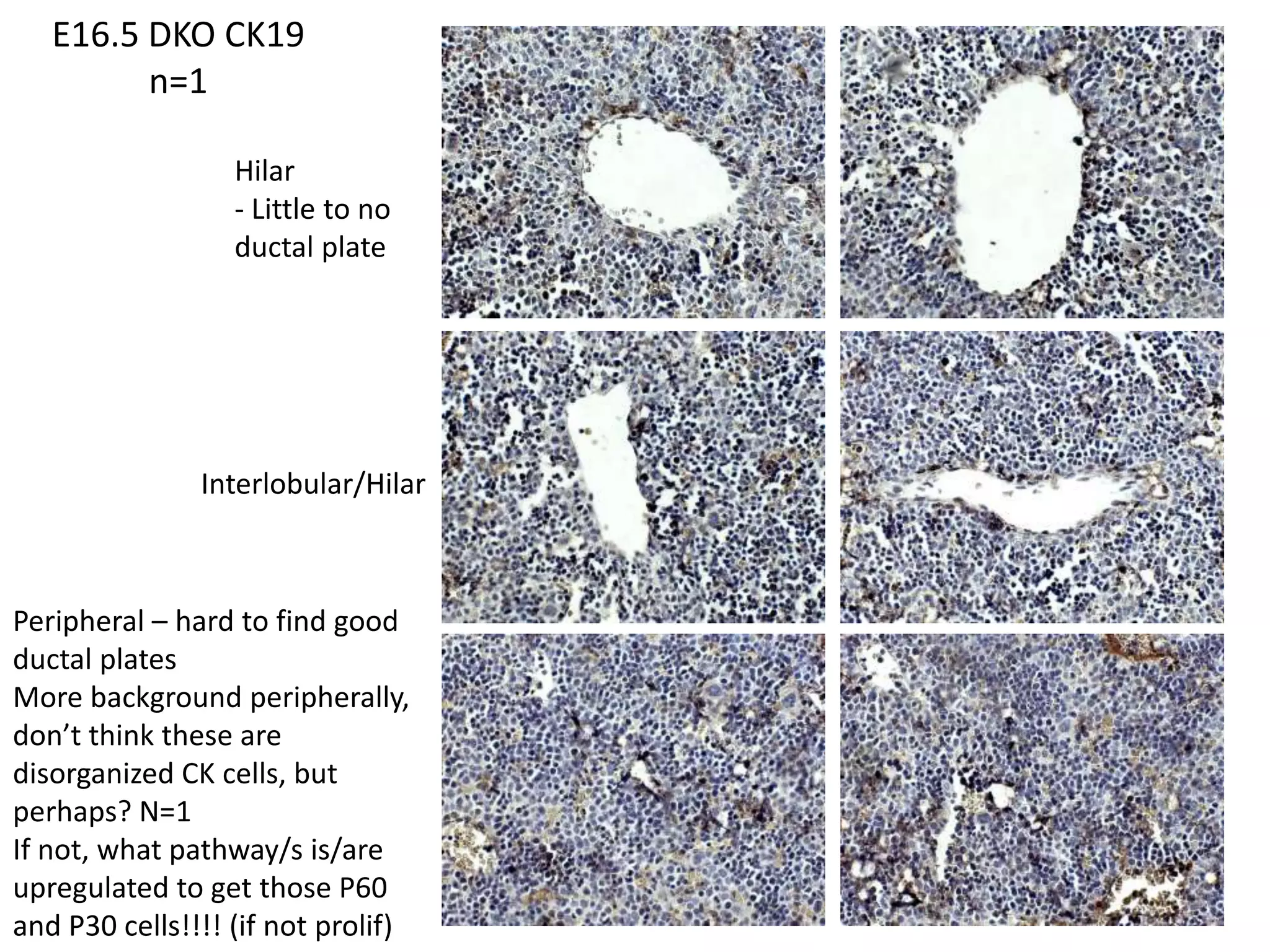 Ck19 slides 4 5 | PPTX