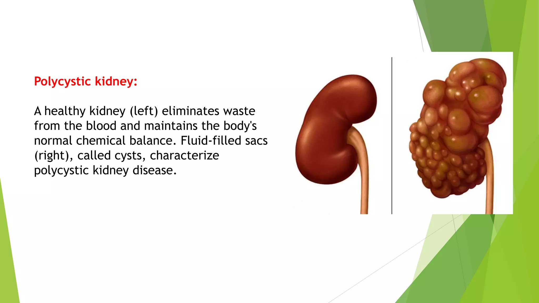Chronic Kidney Disease (CKD) | PPTX