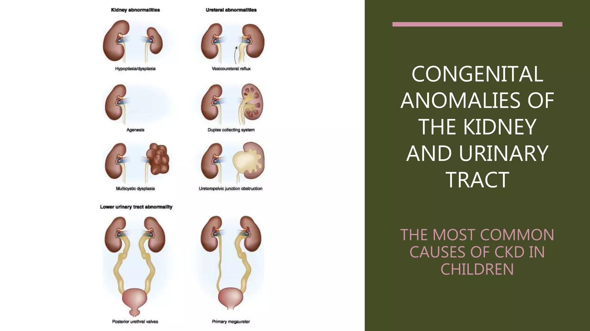 Pediatric Chronic Kidney Diseases.pptx