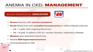 Etiopathogenesis & Mx Of Chronic Kidney Disease | PPTX