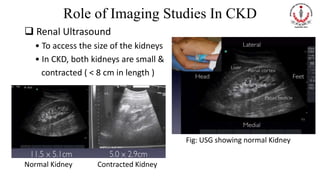 Chronic Kidney Disease - Lab Investigations & Imaging | PPTX