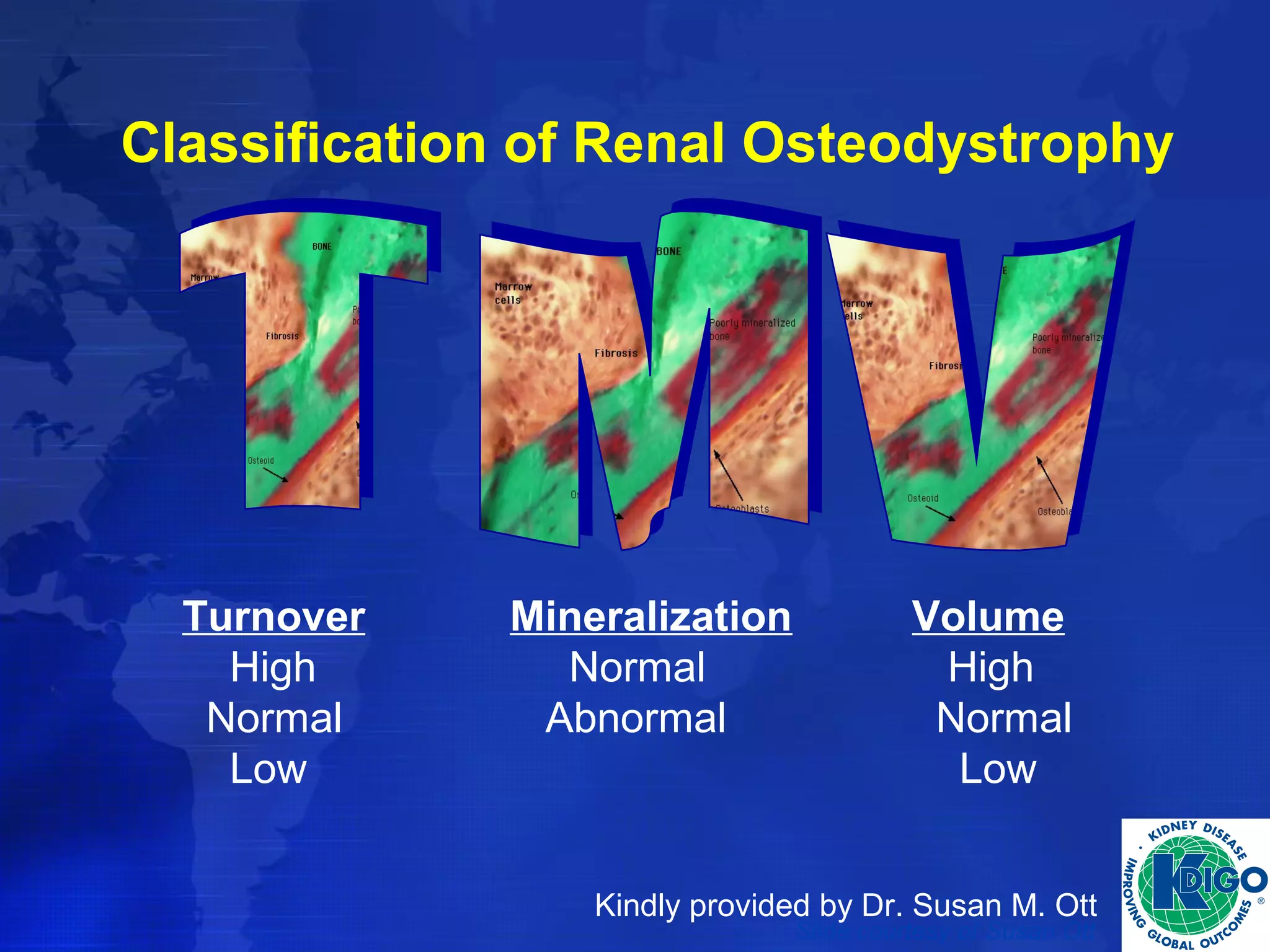 Ckd mbd guideline | PPT