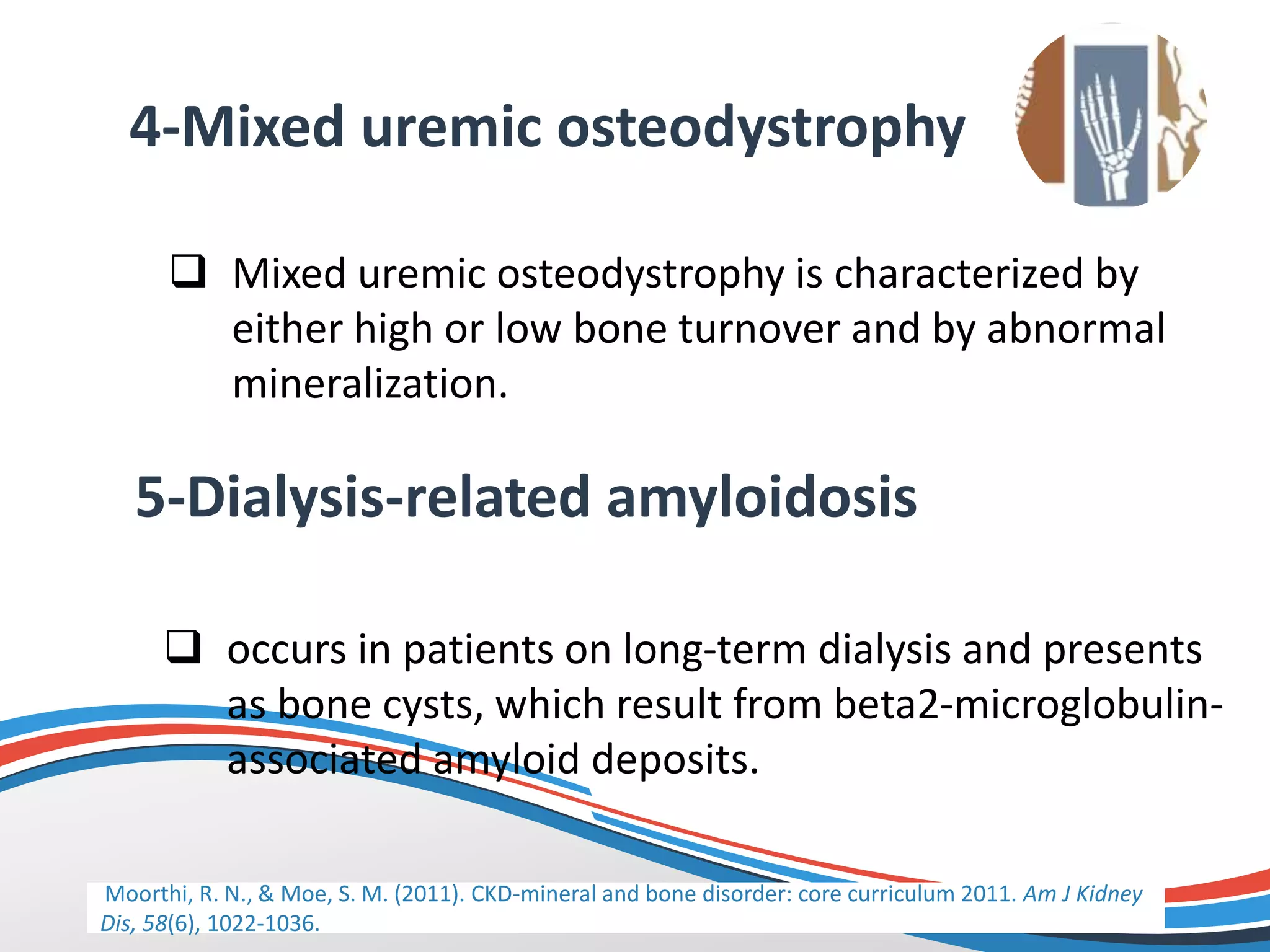 CKD MBD; make it easy | PPTX