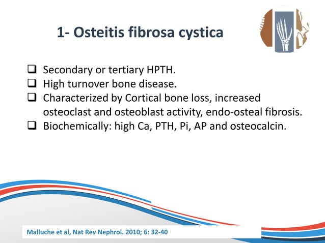 CKD MBD; make it easy | PPTX | Endocrine and Metabolic Diseases ...