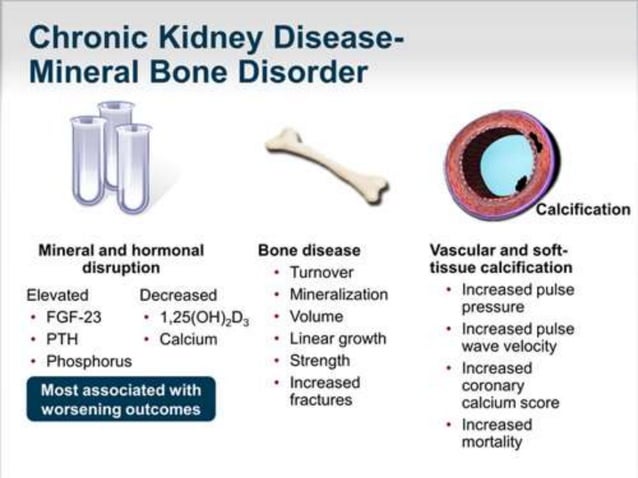 CKD MBD; make it easy | PPTX | Endocrine and Metabolic Diseases ...
