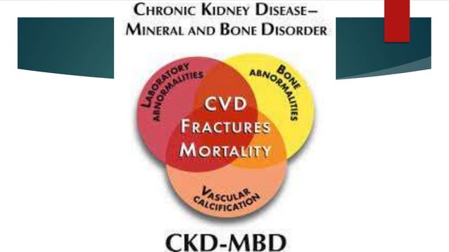 CKD - MBD MODIFIED.pptx