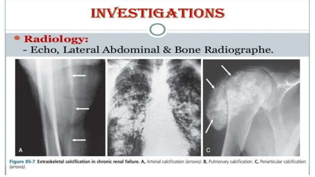 CKD - MBD MODIFIED.pptx