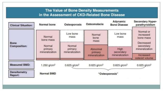CKD - MBD MODIFIED.pptx