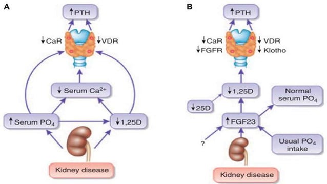 CKD - MBD MODIFIED.pptx