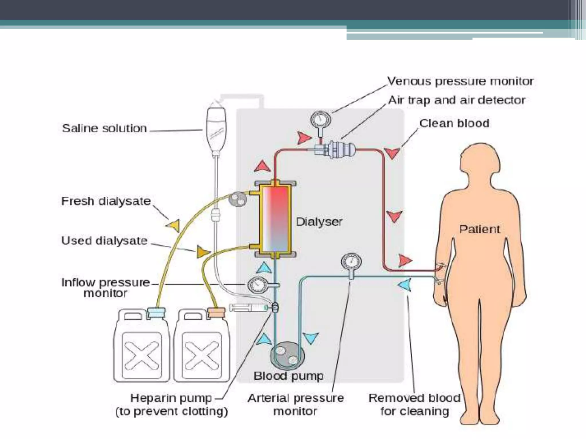 Ckd and dialysis | PPTX